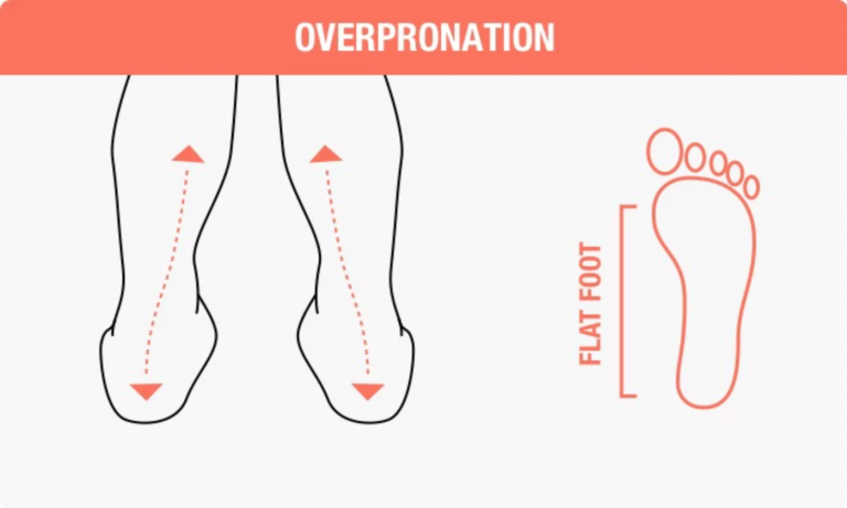 The Best Motion Control Running Shoes! - The Athletic Foot